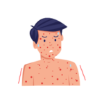 All Disease names in English and their Pictures - ilmish